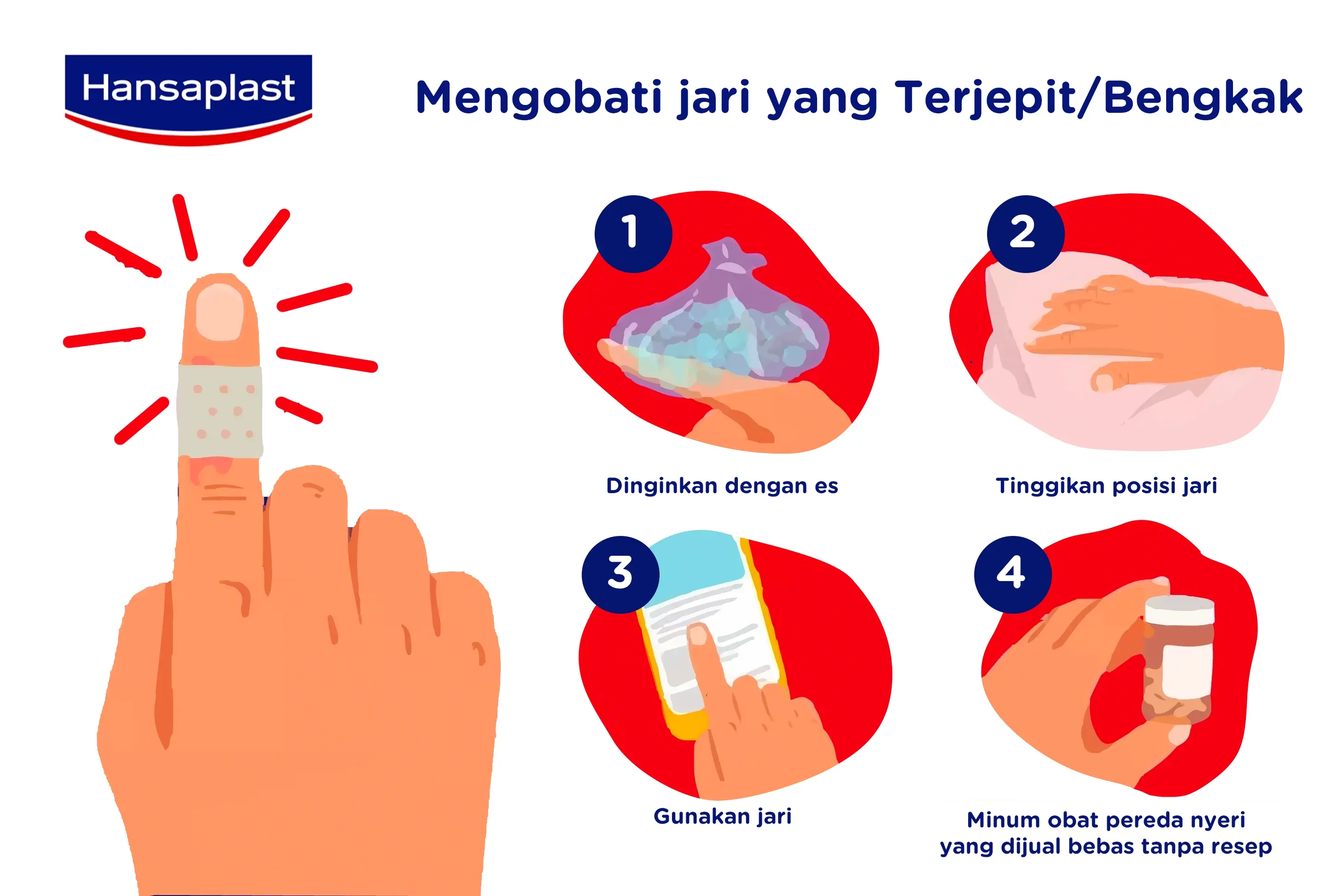 5 Cara Menghilangkan Bengkak di Tangan Setelah Terjepit